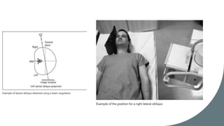 X-ray imaging planes and terminologies | PPTX