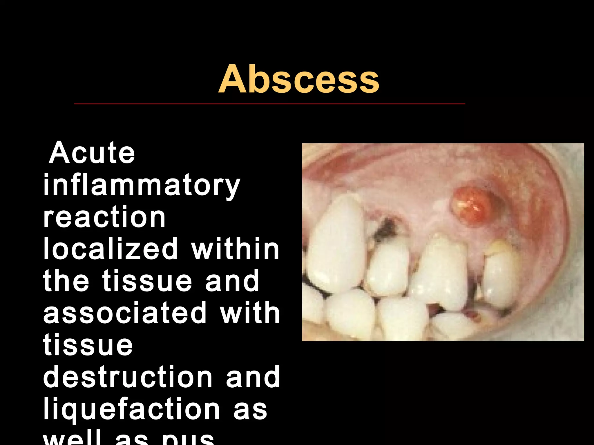 Terminology used in oral pathology dental | PPT