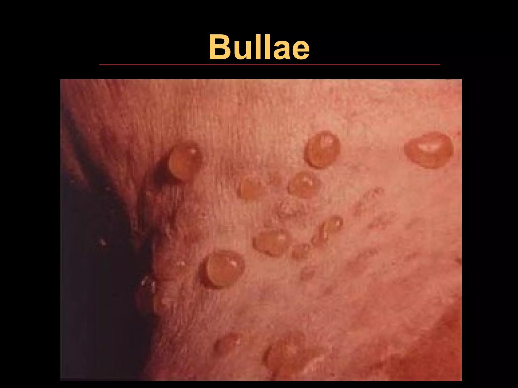 Terminology used in oral pathology dental | PPT