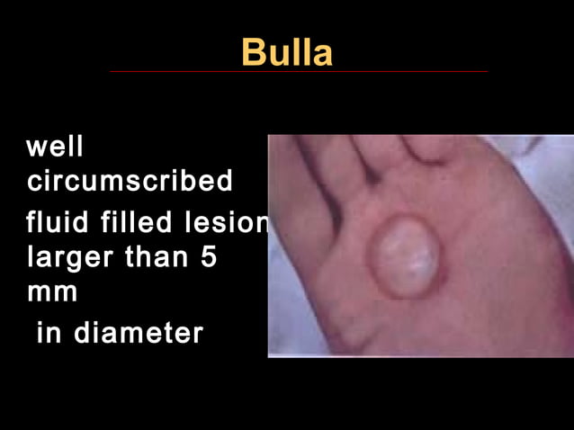 Terminology used in oral pathology dental | PPT | Dental Health ...