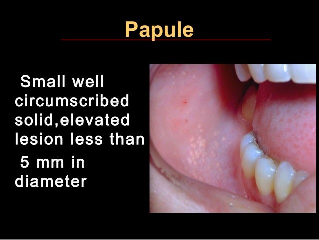 Terminology used in oral pathology dental