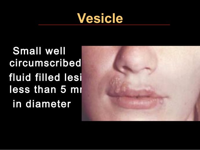 Terminology used in oral pathology dental