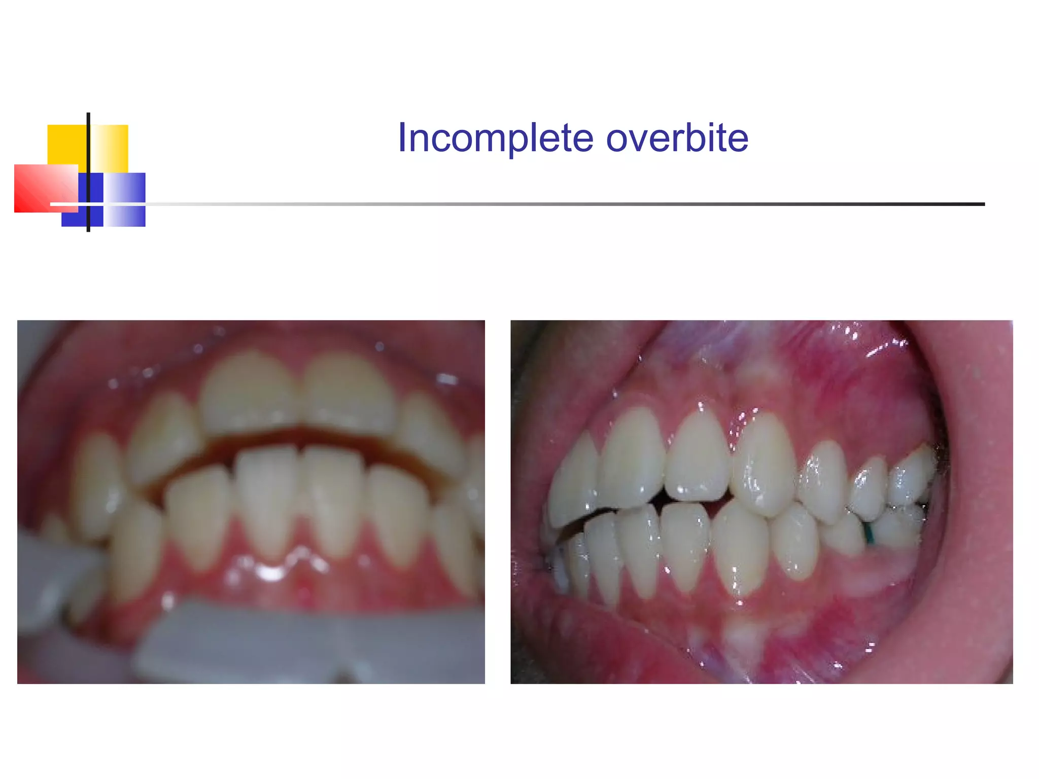 Terminology in Orthodontics | PPT