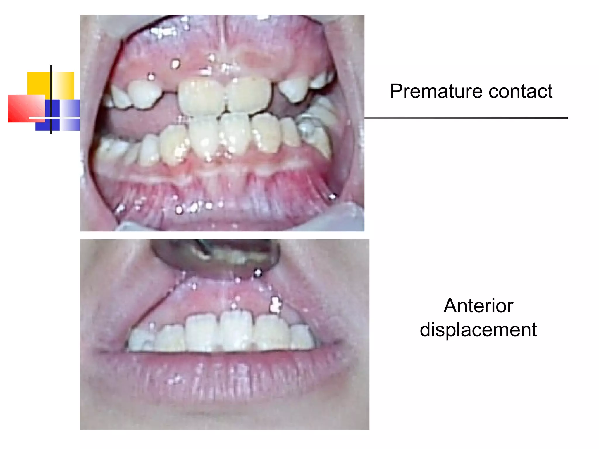 Terminology in Orthodontics | PPT