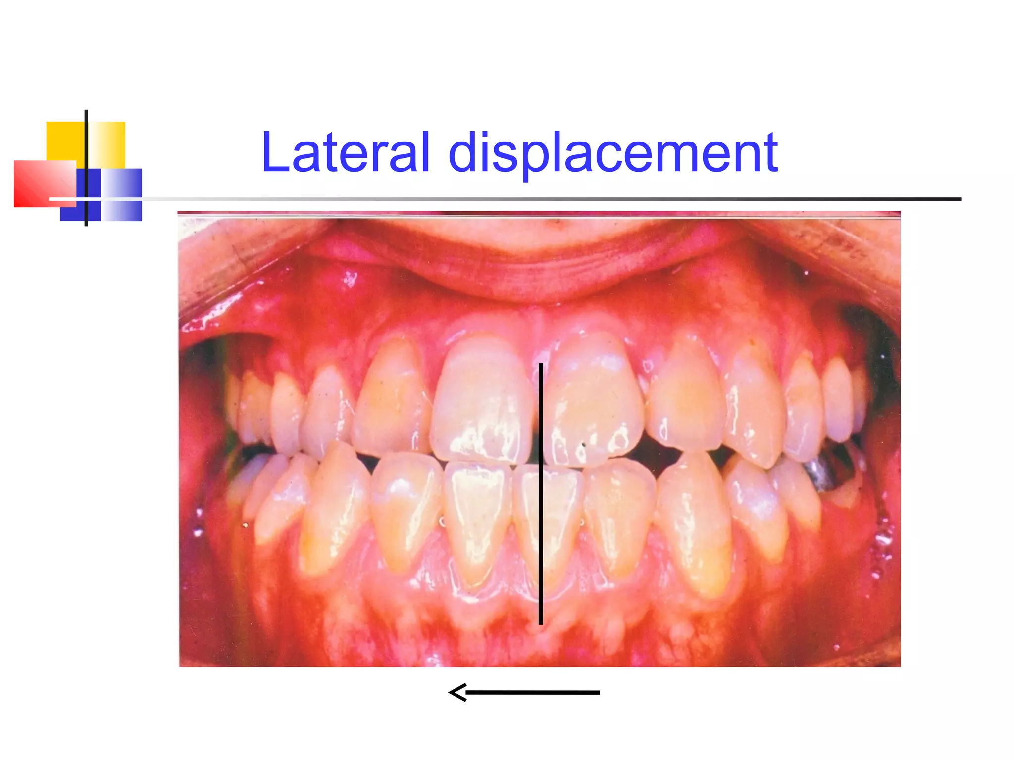 Terminology in Orthodontics | PPT