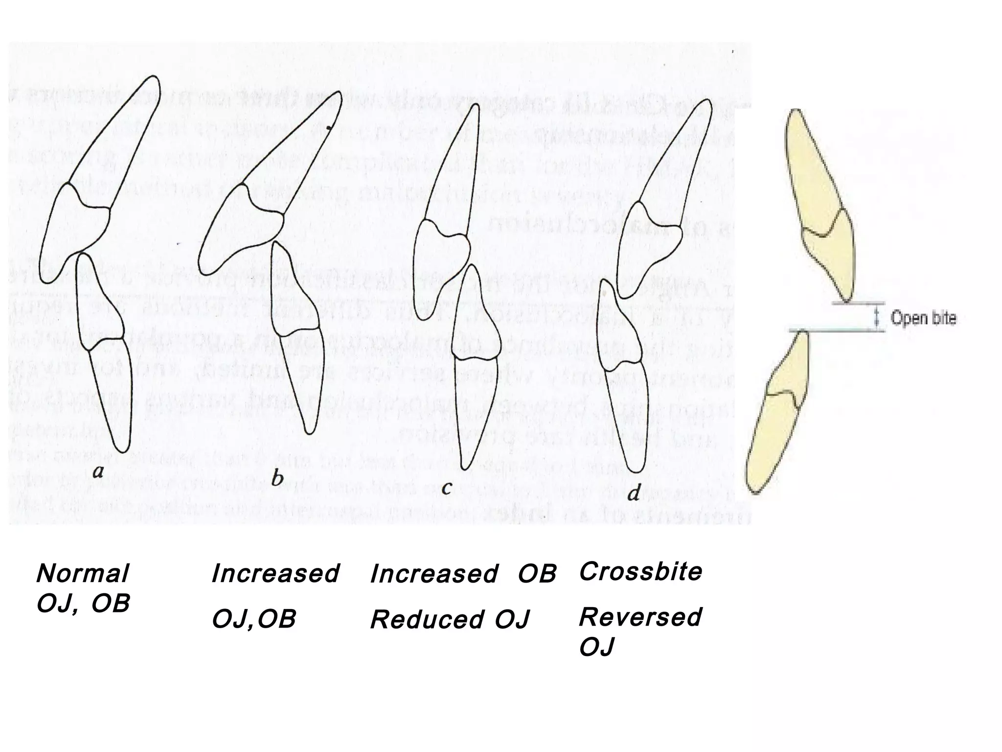 Terminology in Orthodontics | PPT