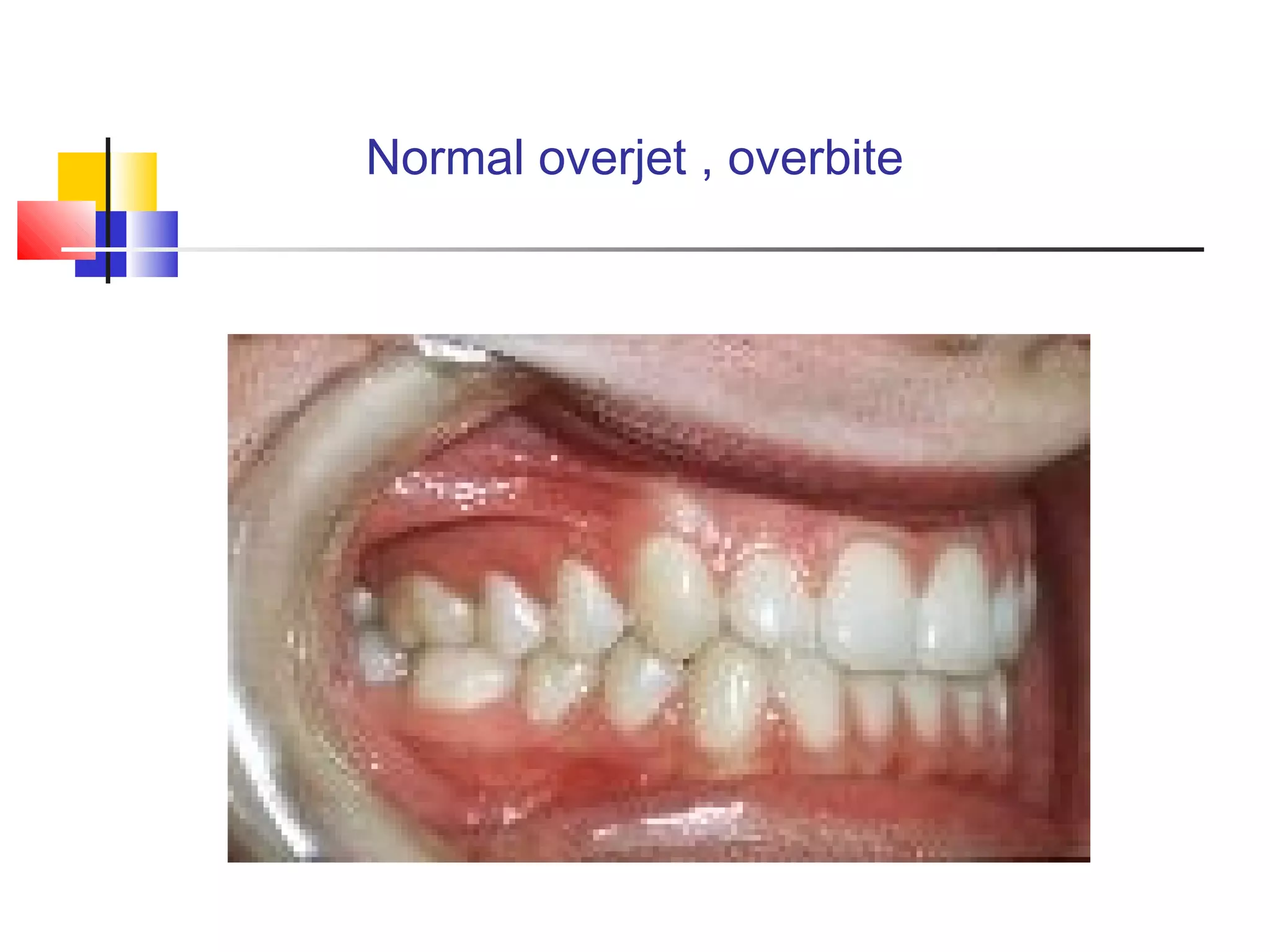 Terminology in Orthodontics | PPT