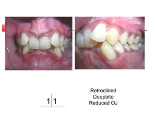 Terminology in Orthodontics | PPT