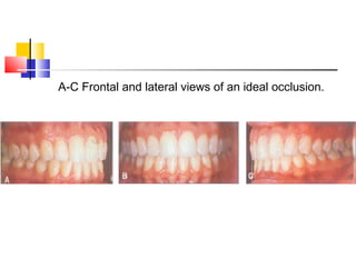 Terminology in Orthodontics | PPT
