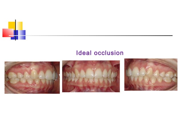 Terminology in Orthodontics | PPT | Dental Health | Diseases and Conditions