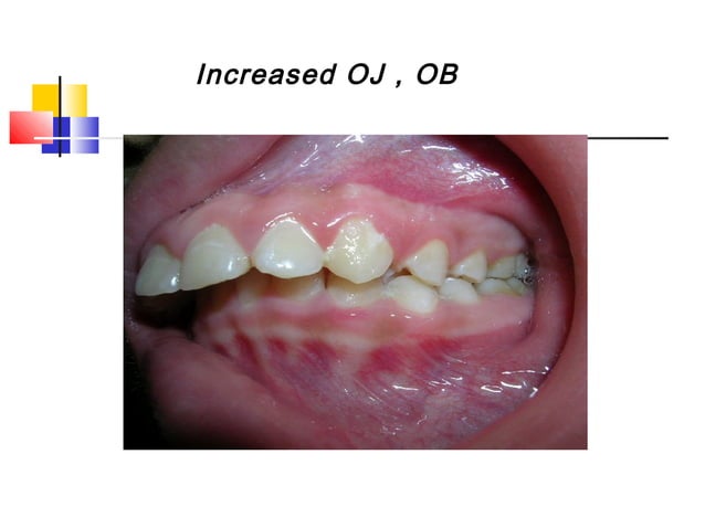 Terminology in Orthodontics | PPT | Dental Health | Diseases and Conditions