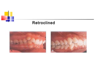 Terminology in Orthodontics | PPT
