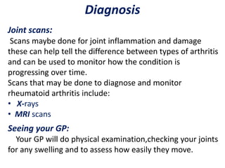 Rheumatoid Arthritis | PPT