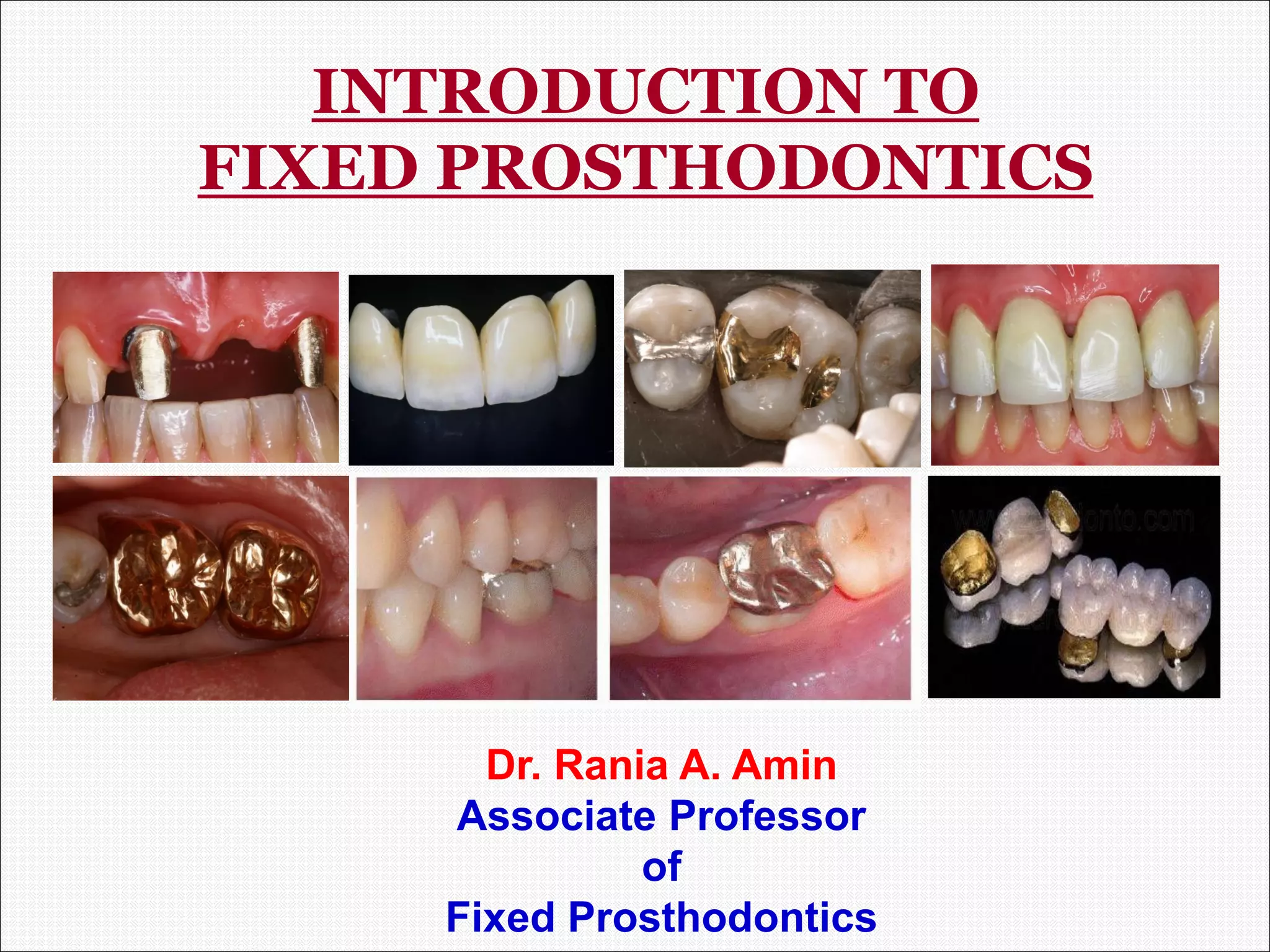 Terminology and classification of fixed prosthodontics | PDF