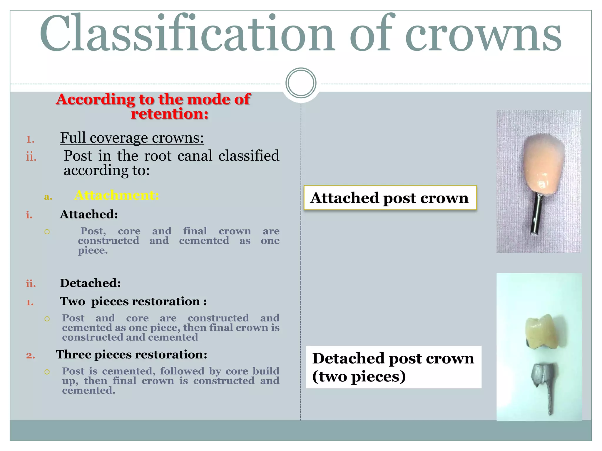 Terminology and classification of fixed prosthodontics | PDF