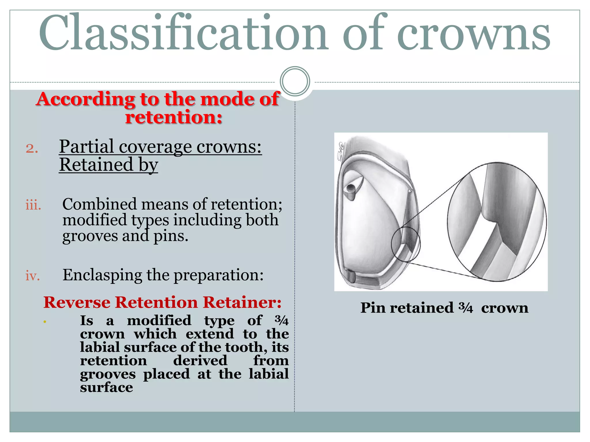 Terminology and classification of fixed prosthodontics | PDF