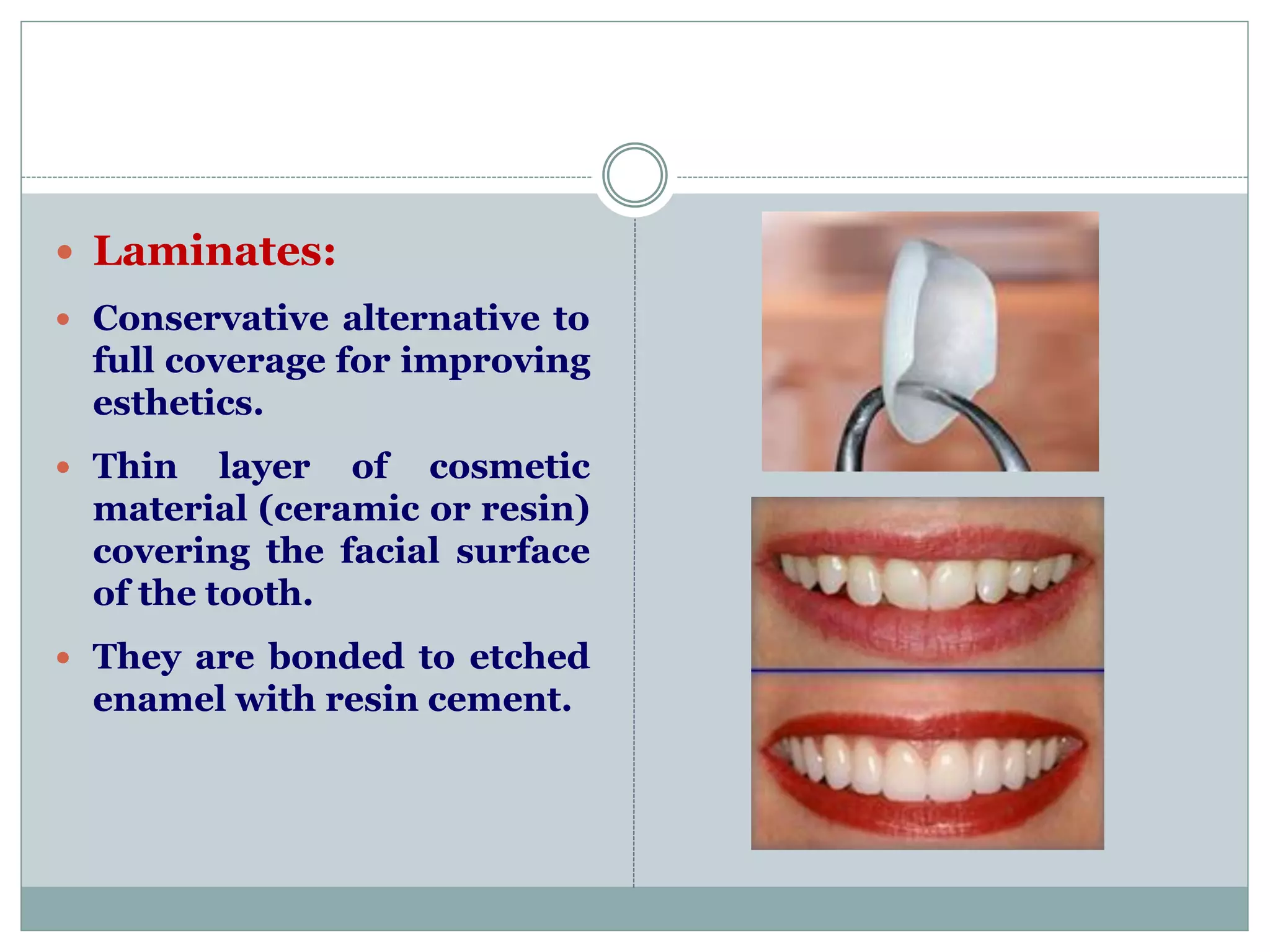 Terminology and classification of fixed prosthodontics | PDF