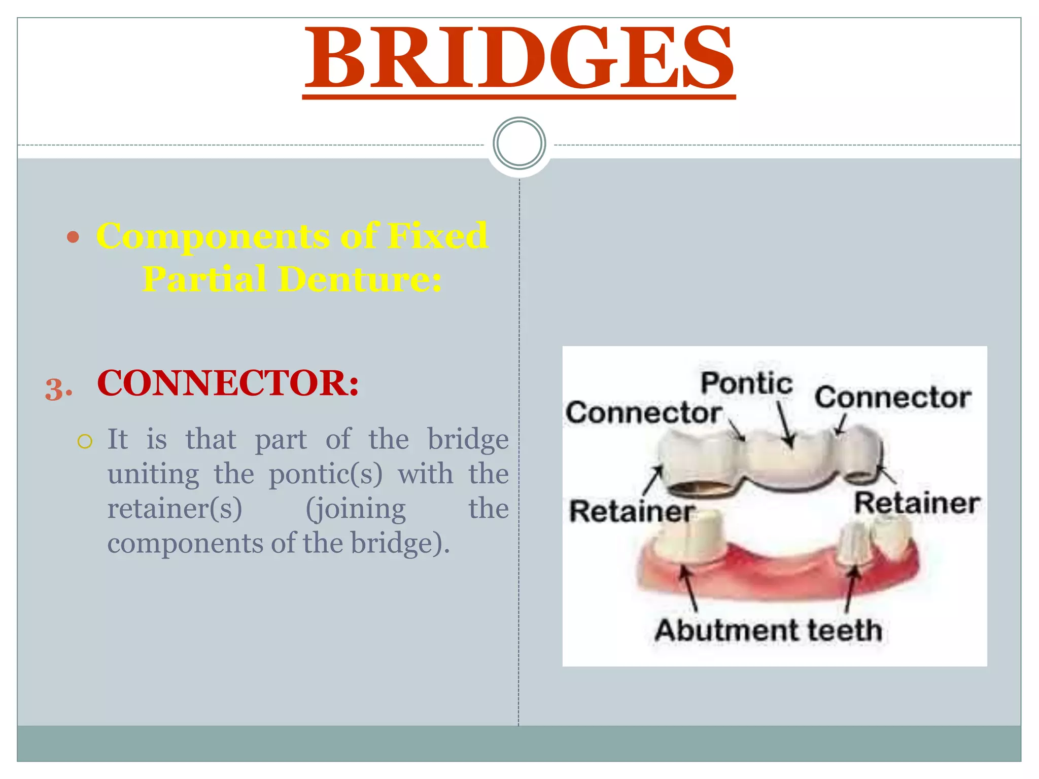 Terminology and classification of fixed prosthodontics | PDF