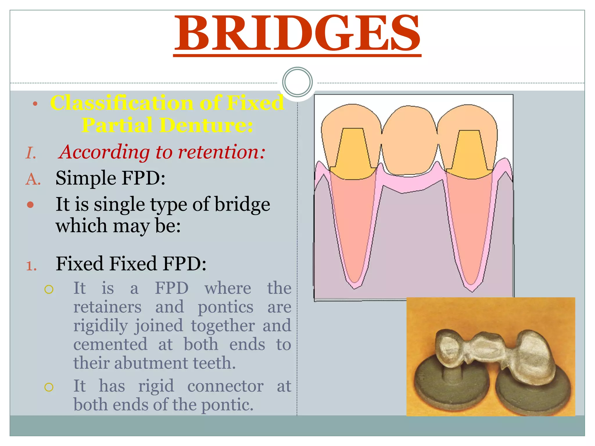 Terminology and classification of fixed prosthodontics | PDF