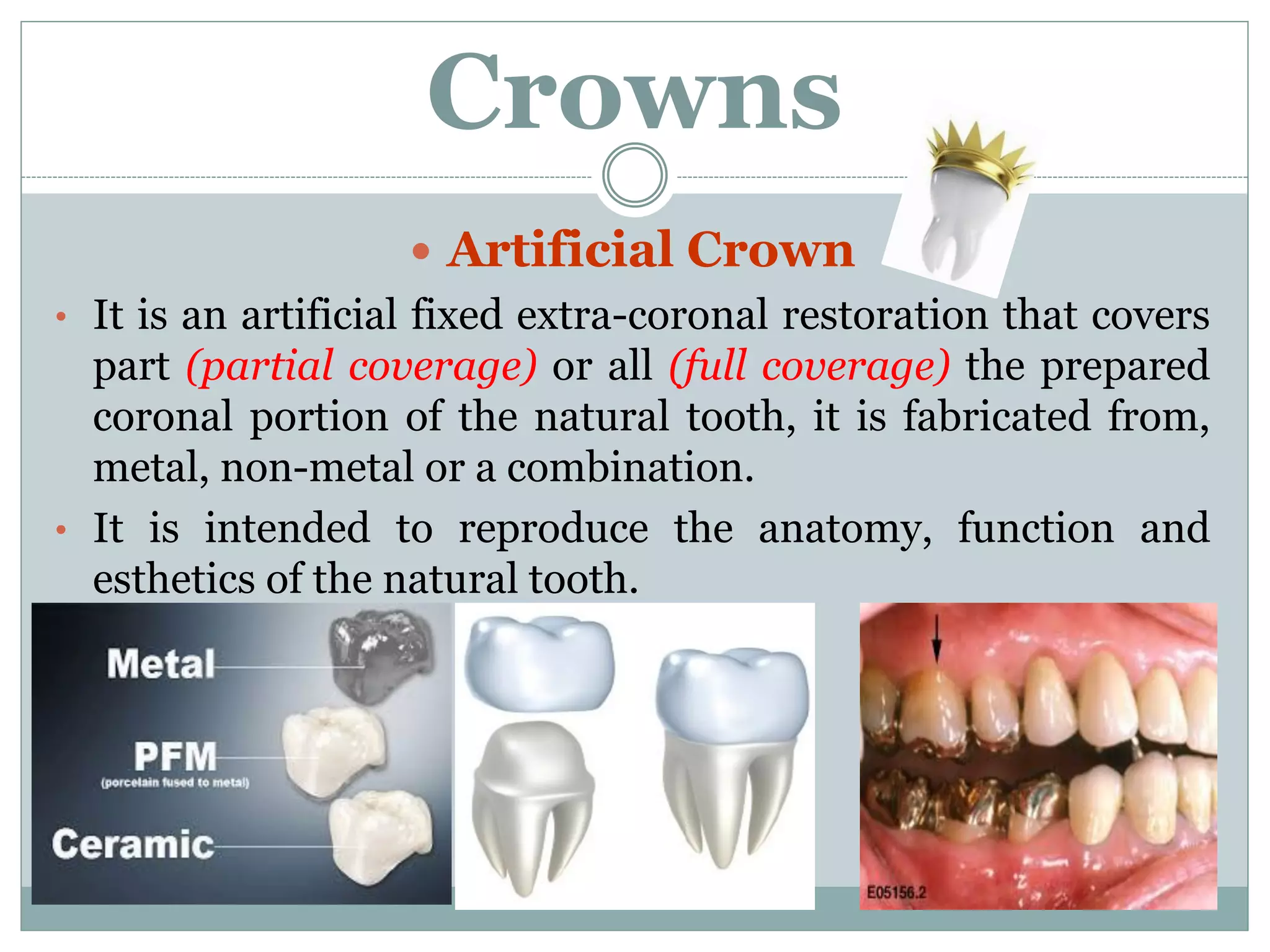 Terminology and classification of fixed prosthodontics | PDF