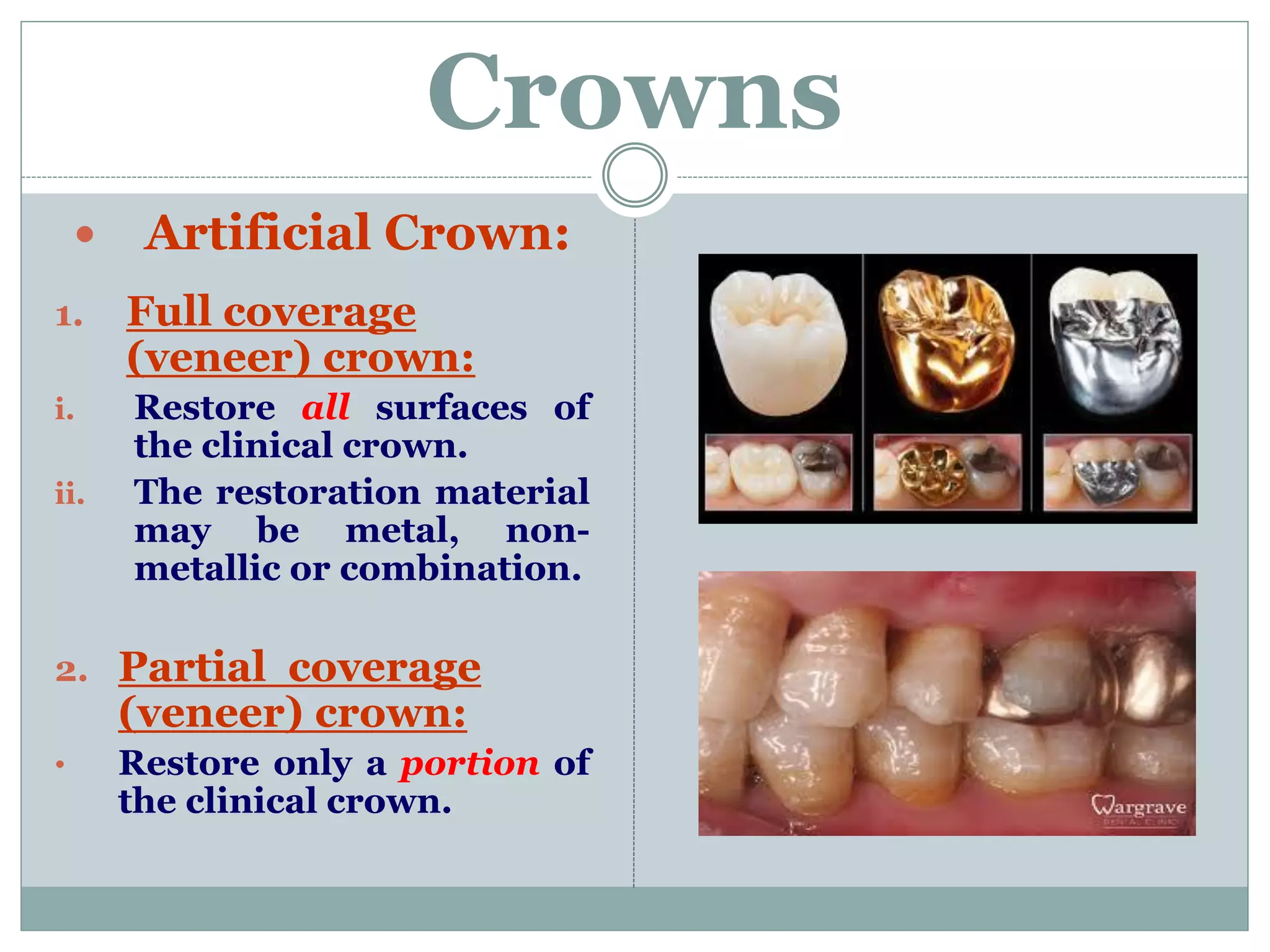 Terminology and classification of fixed prosthodontics | PDF
