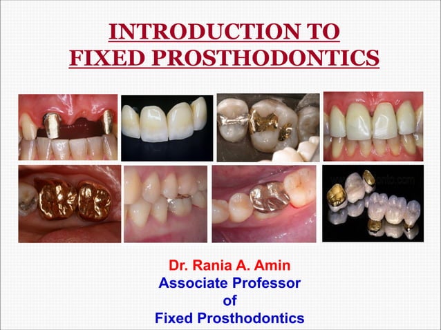 Terminology and classification of fixed prosthodontics | PDF | Oral ...