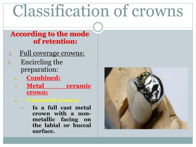 Terminology and classification of fixed prosthodontics | PDF | Oral ...