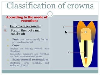 Terminology and classification of fixed prosthodontics | PDF