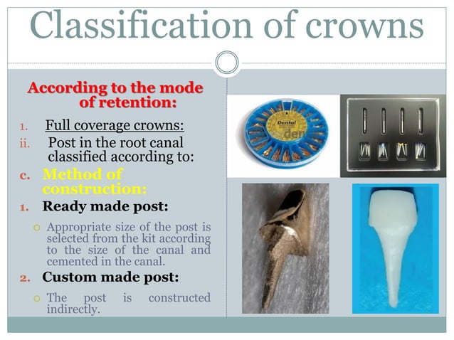Terminology and classification of fixed prosthodontics | PDF | Oral ...