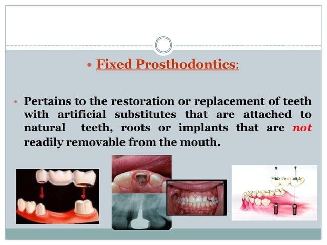 Terminology and classification of fixed prosthodontics | PDF | Oral ...
