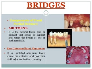 Terminology and classification of fixed prosthodontics | PDF