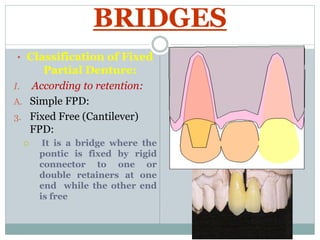Terminology and classification of fixed prosthodontics | PDF