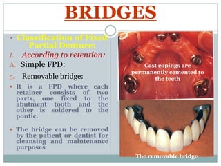 Terminology and classification of fixed prosthodontics | PDF