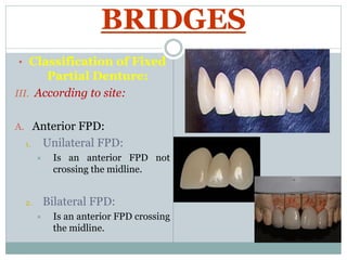 Terminology and classification of fixed prosthodontics | PDF