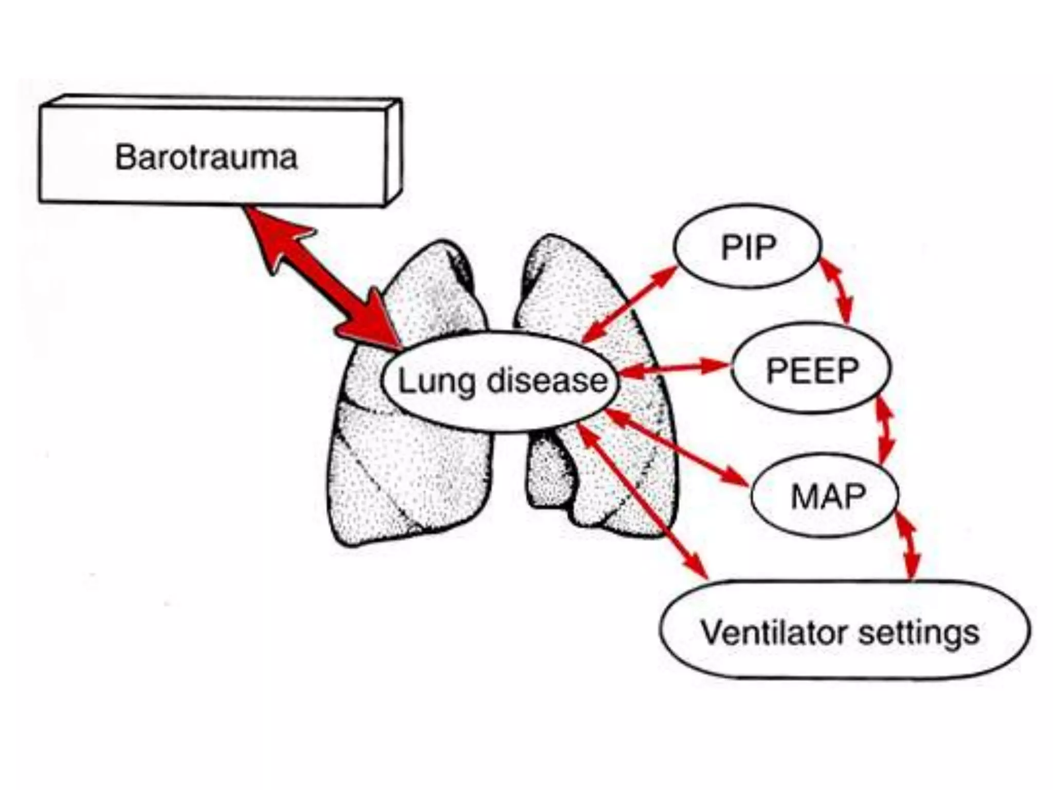 Terminology mechanical ventilation | PPTX