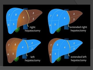 Terminology of liver anatomy and resections.pptx