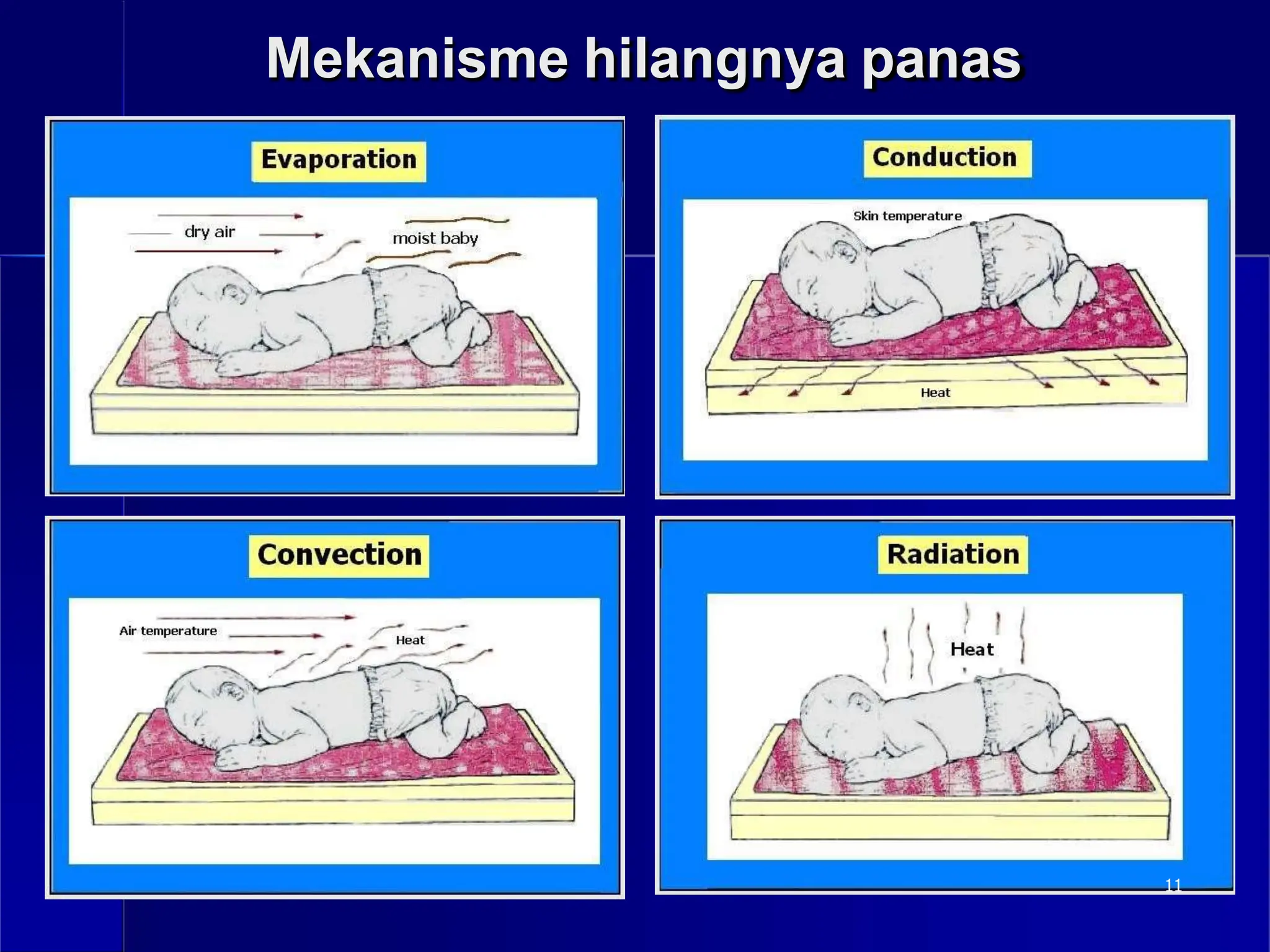 termoregulasi neonatus, bayi dan balita.pptx