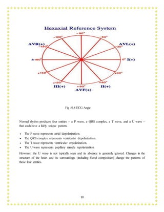 Term paper on ECG and cardiac arrhythmias | DOCX