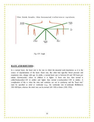 Term paper on ECG and cardiac arrhythmias | PDF