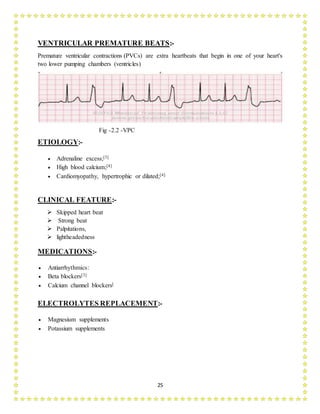 Term paper on ECG and cardiac arrhythmias | PDF