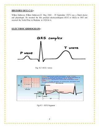 Term paper on ECG and cardiac arrhythmias | PDF