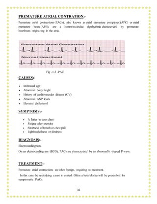 Term paper on ecg and cardiac arrhythmias | DOCX