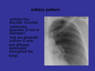 Terms for thoracic imaging 3 | PPT