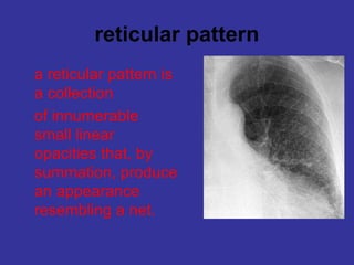Terms for thoracic imaging 3 | PPT