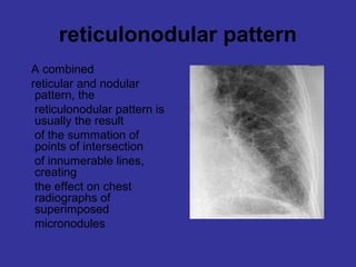 Terms for thoracic imaging 3 | PPT