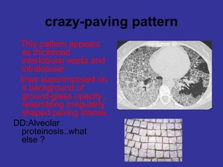 Terms for thoracic imaging 3 | PPT