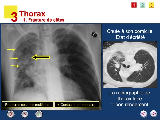 Traumatologie, Terrain