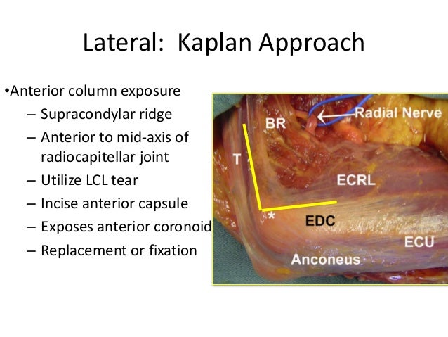 Terrible triad - elbow