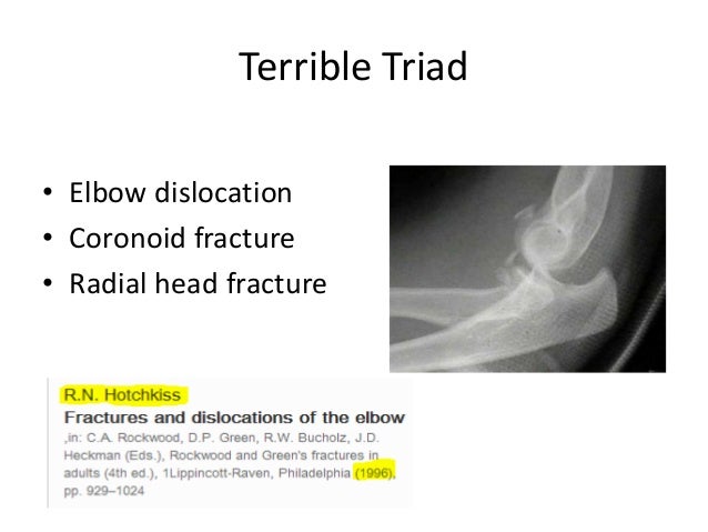 Terrible triad - elbow