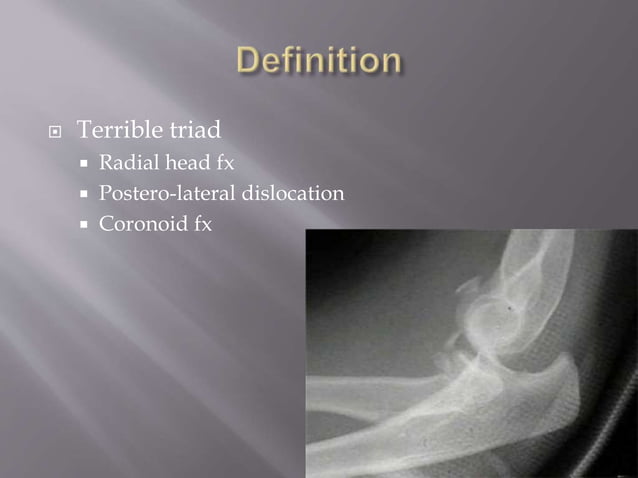 Terrible Triad | PPTX